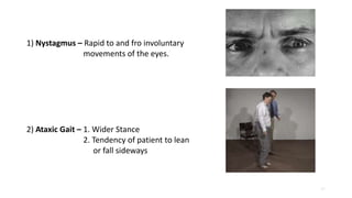 Cerebellar Syndrome Anatomy for Undergraduates | PPTX