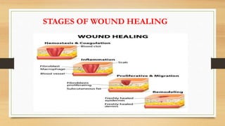 main teaching wound.pptx bsc nursing 4th year | PPTX