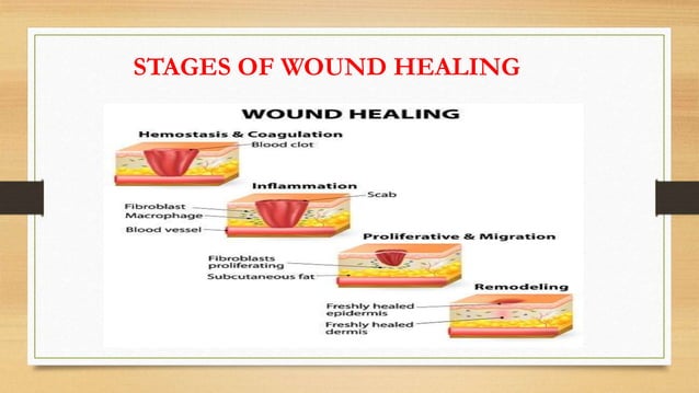 main teaching wound.pptx bsc nursing 4th year | PPT
