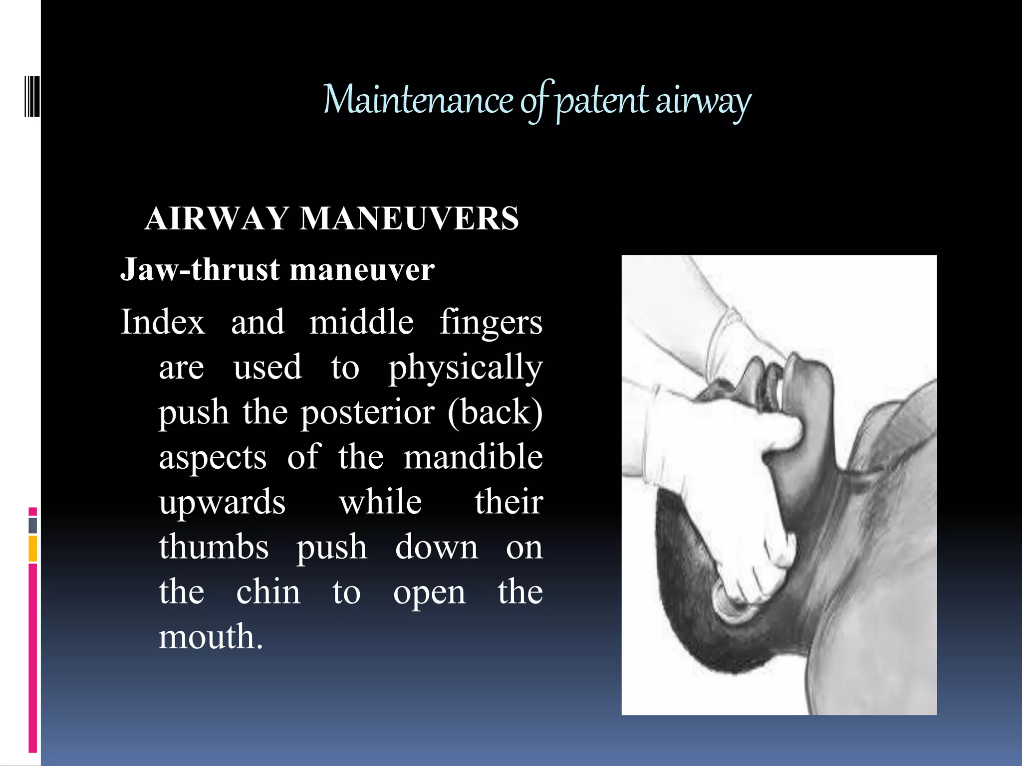 Maintenace of patent airway | PPTX