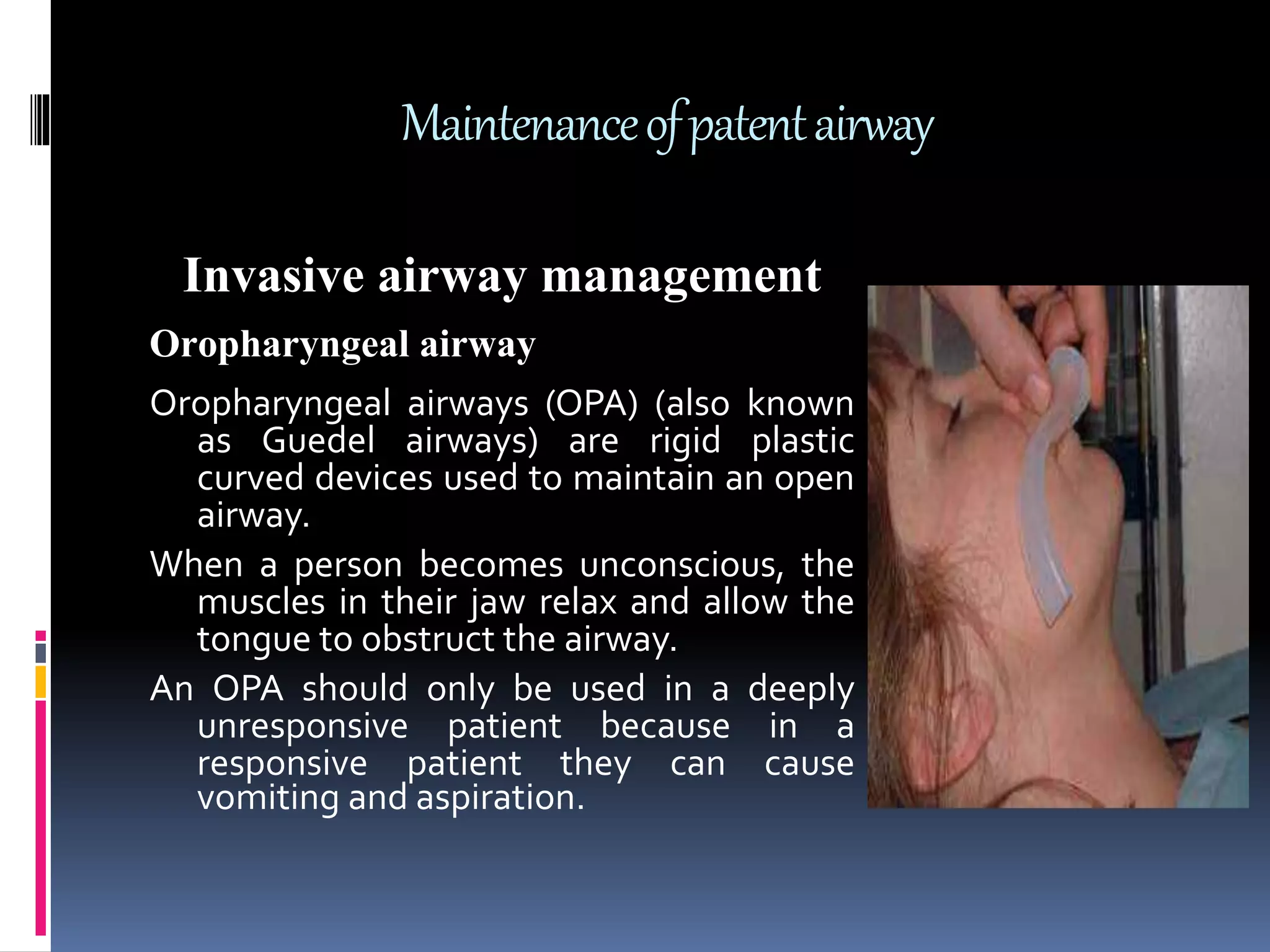 Maintenace of patent airway | PPTX
