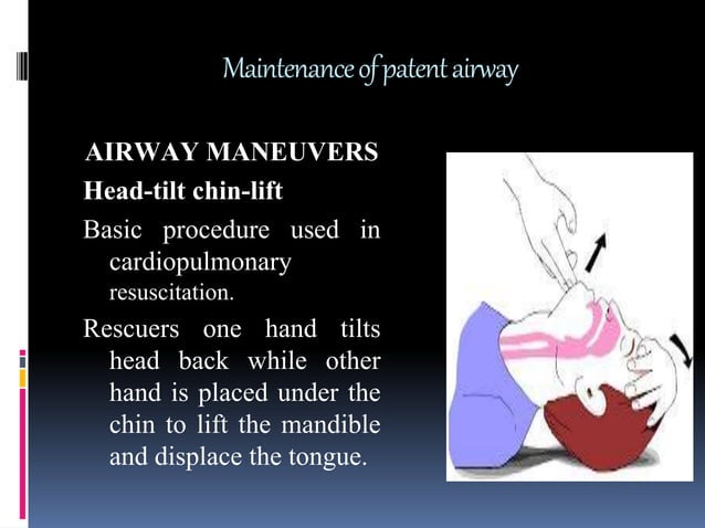 Maintenace of patent airway | PPTX | First Aid | Injuries
