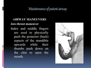 Maintenace of patent airway | PPTX