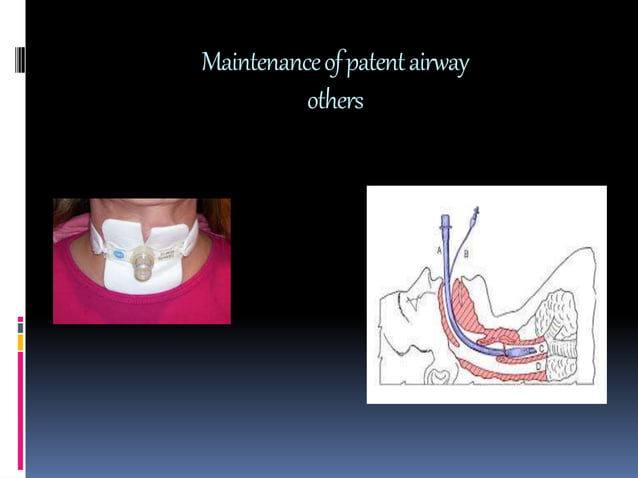 Maintenace of patent airway | PPTX | First Aid | Injuries