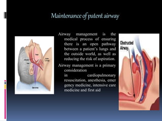Maintenace of patent airway | PPT