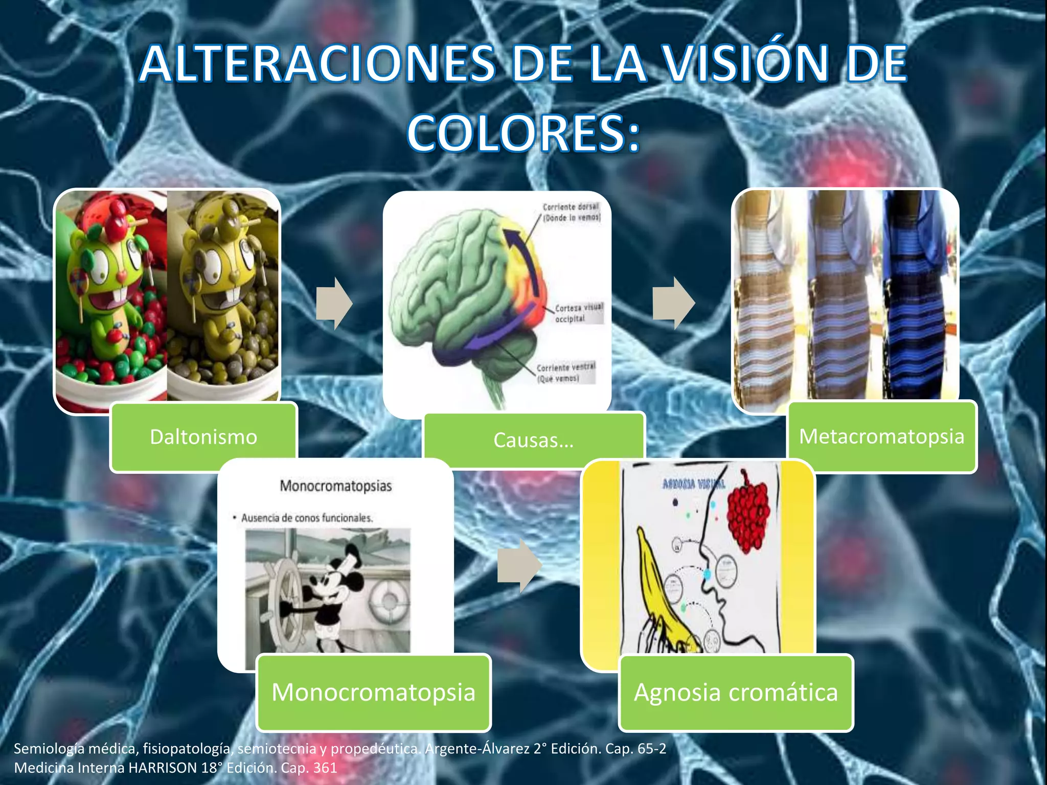 Semiologia de Pares craneales | PPTX | Eye and Vision Conditions ...