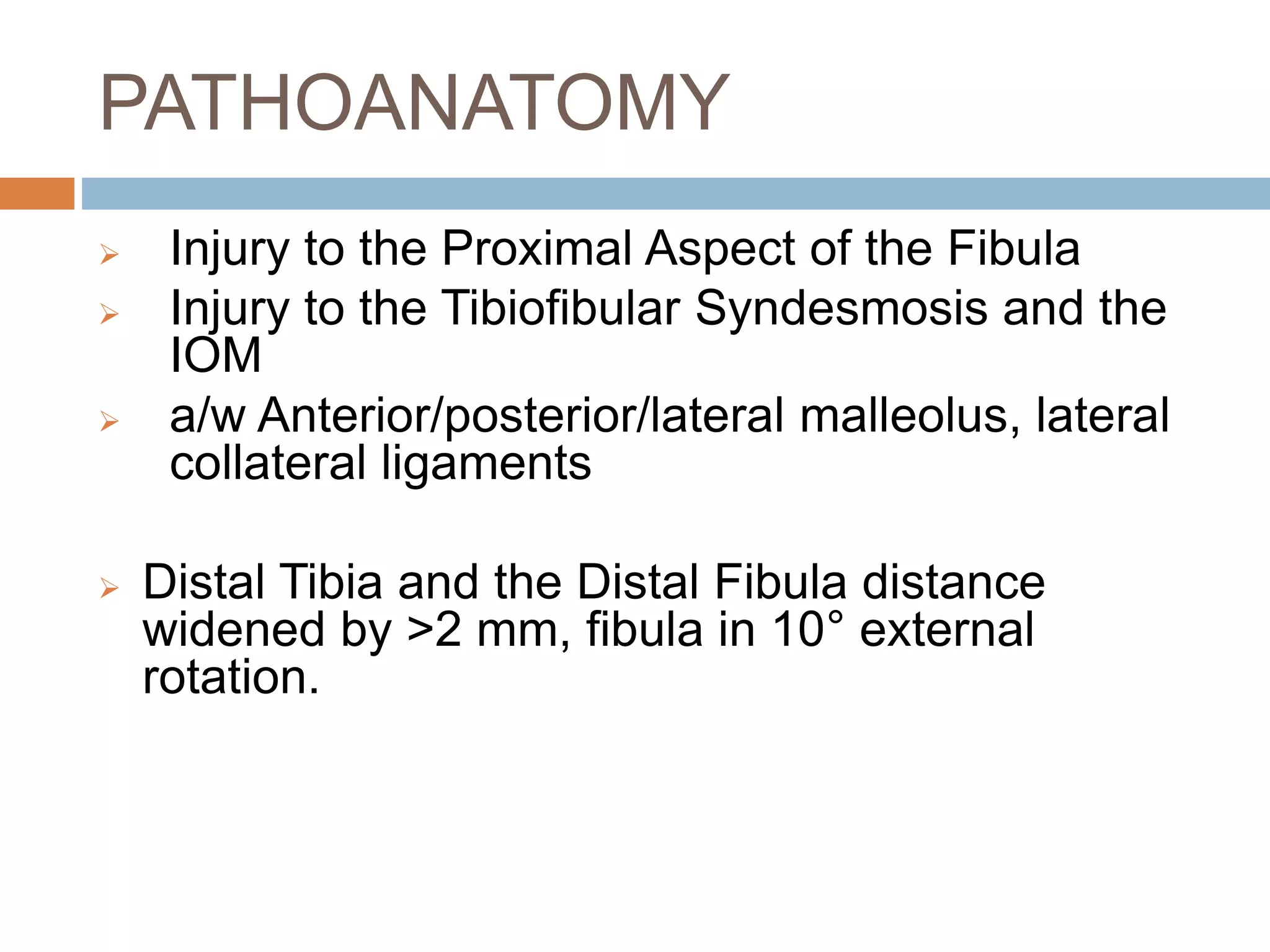 Maisonneuve fracture of ankle joint | PPTX