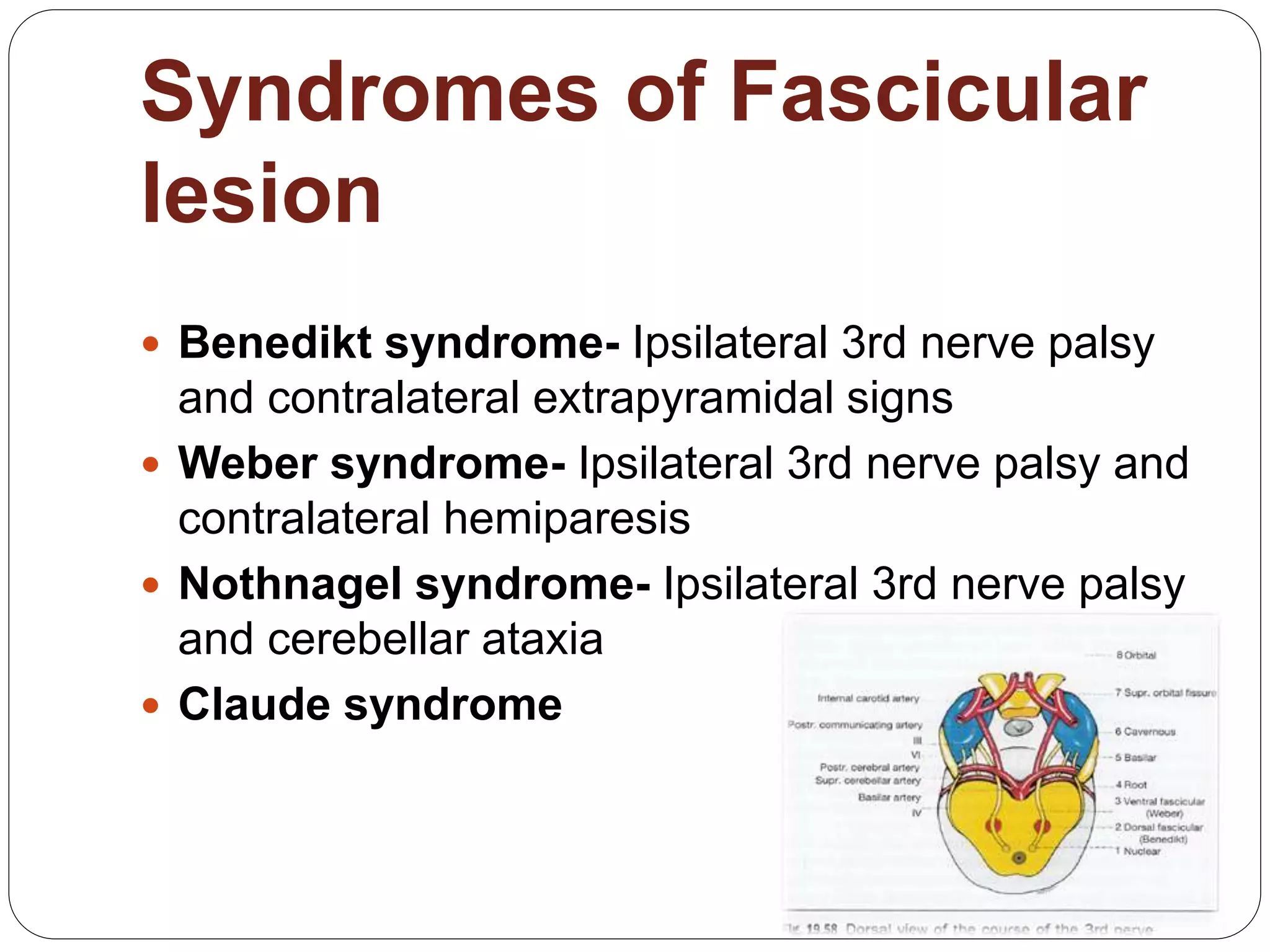 3rd nerve palsy | PPTX
