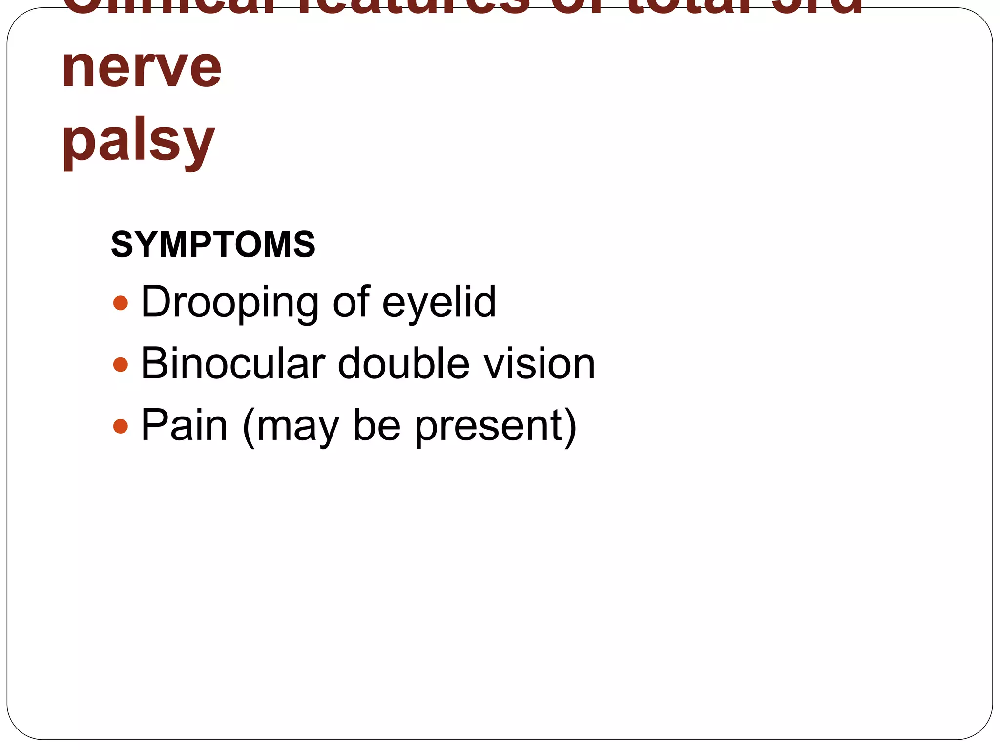 3rd nerve palsy | PPTX