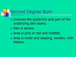 Major burn management | PPT