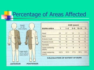 Major burn management | PPT