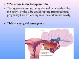 Major Complications in Pregnancy | PPT