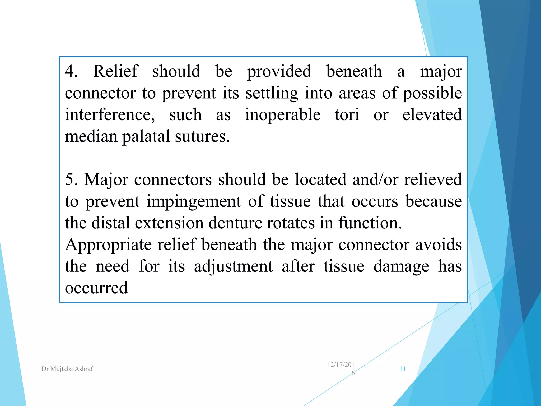 Major connector In prosthodontics | PPTX