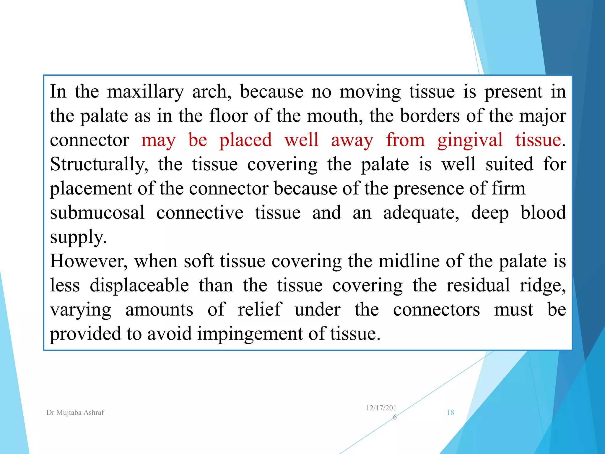 Major connector In prosthodontics | PPTX