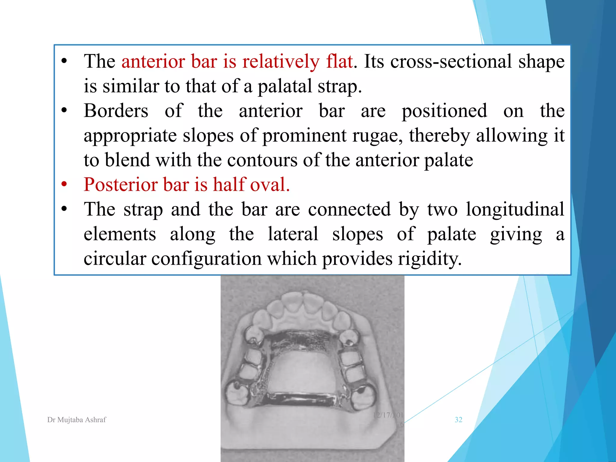 Major connector In prosthodontics | PPTX