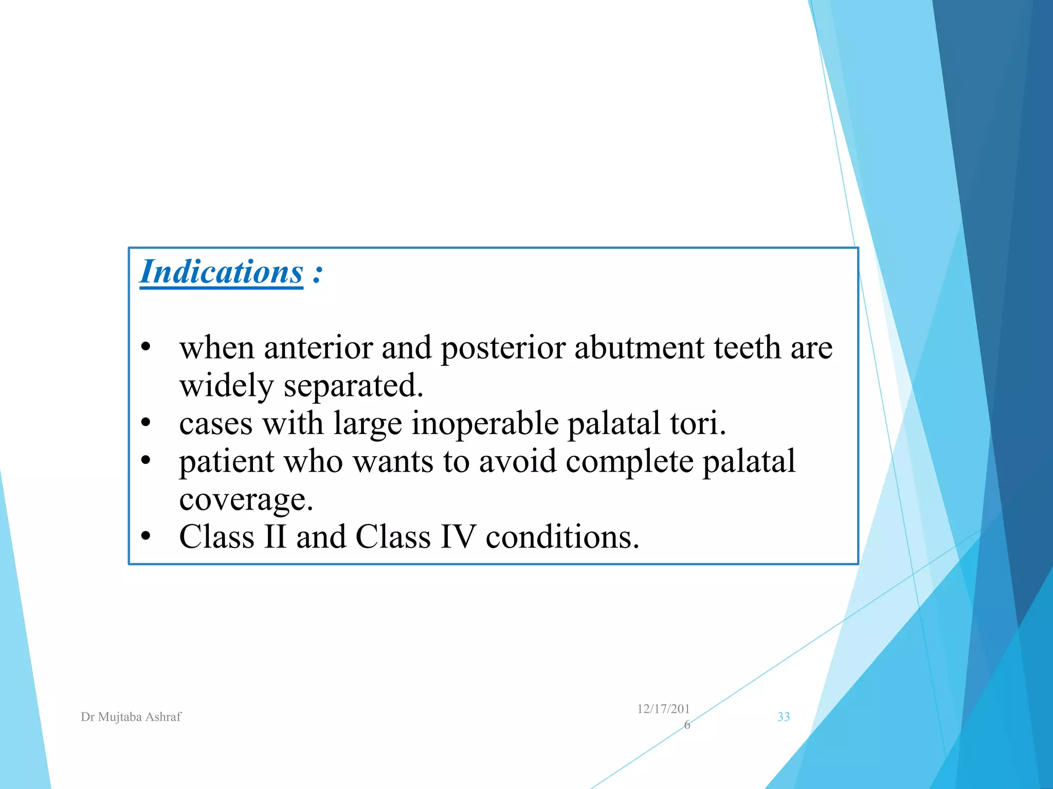 Major connector In prosthodontics | PPTX
