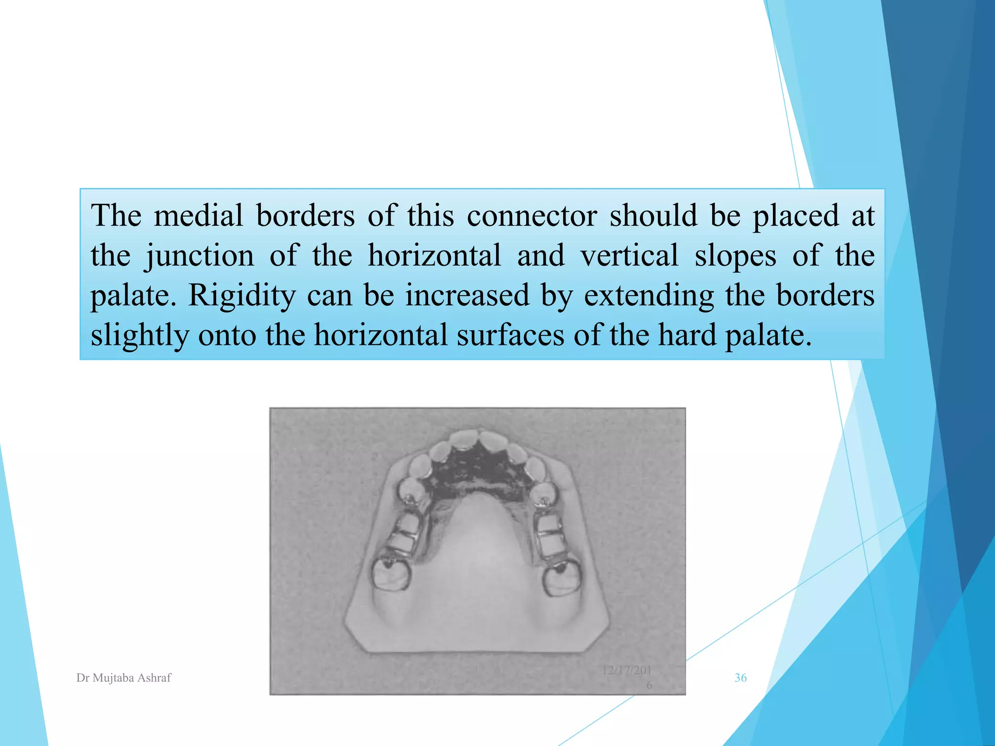 Major connector In prosthodontics | PPTX