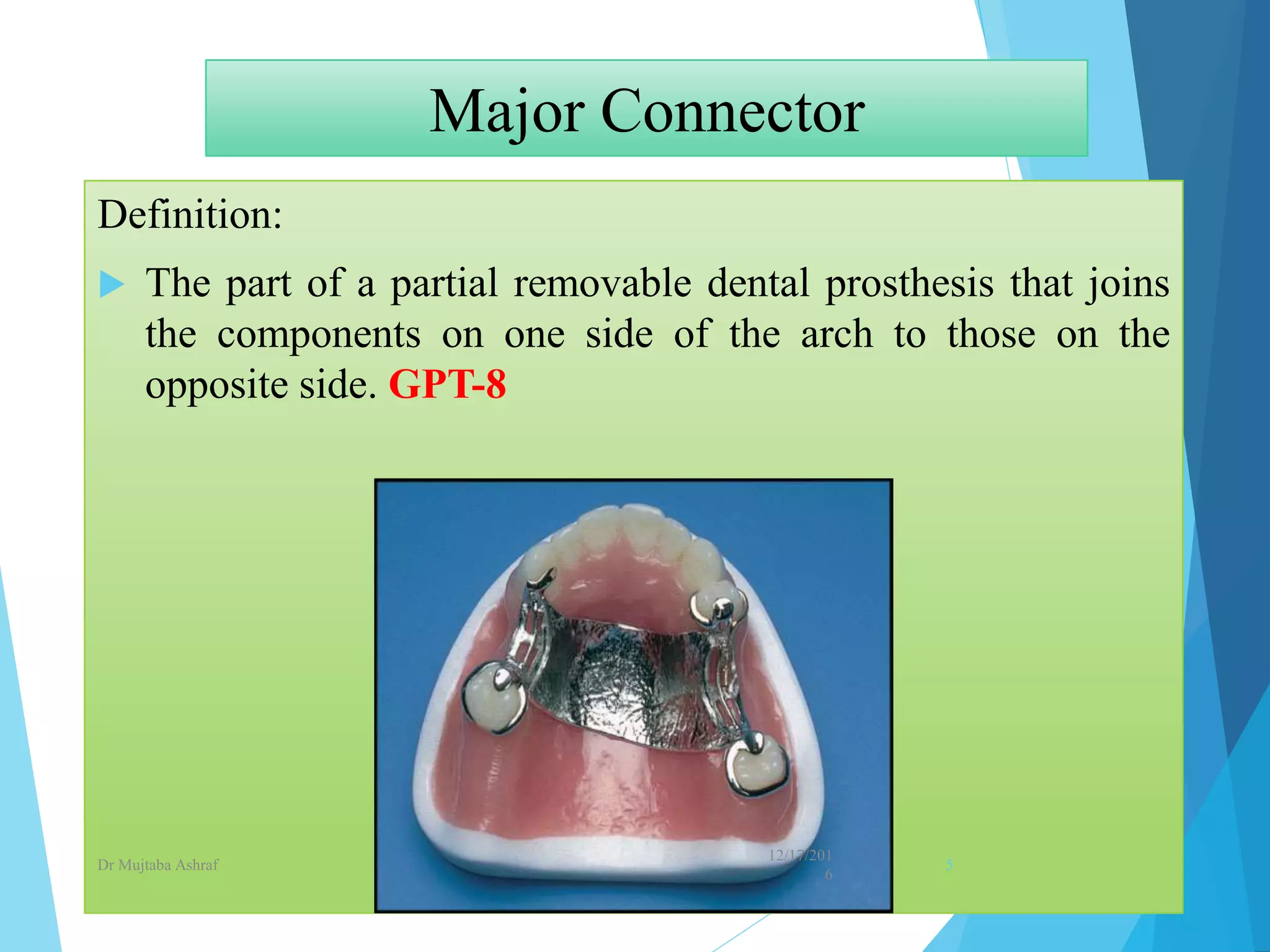 Major connector In prosthodontics | PPTX