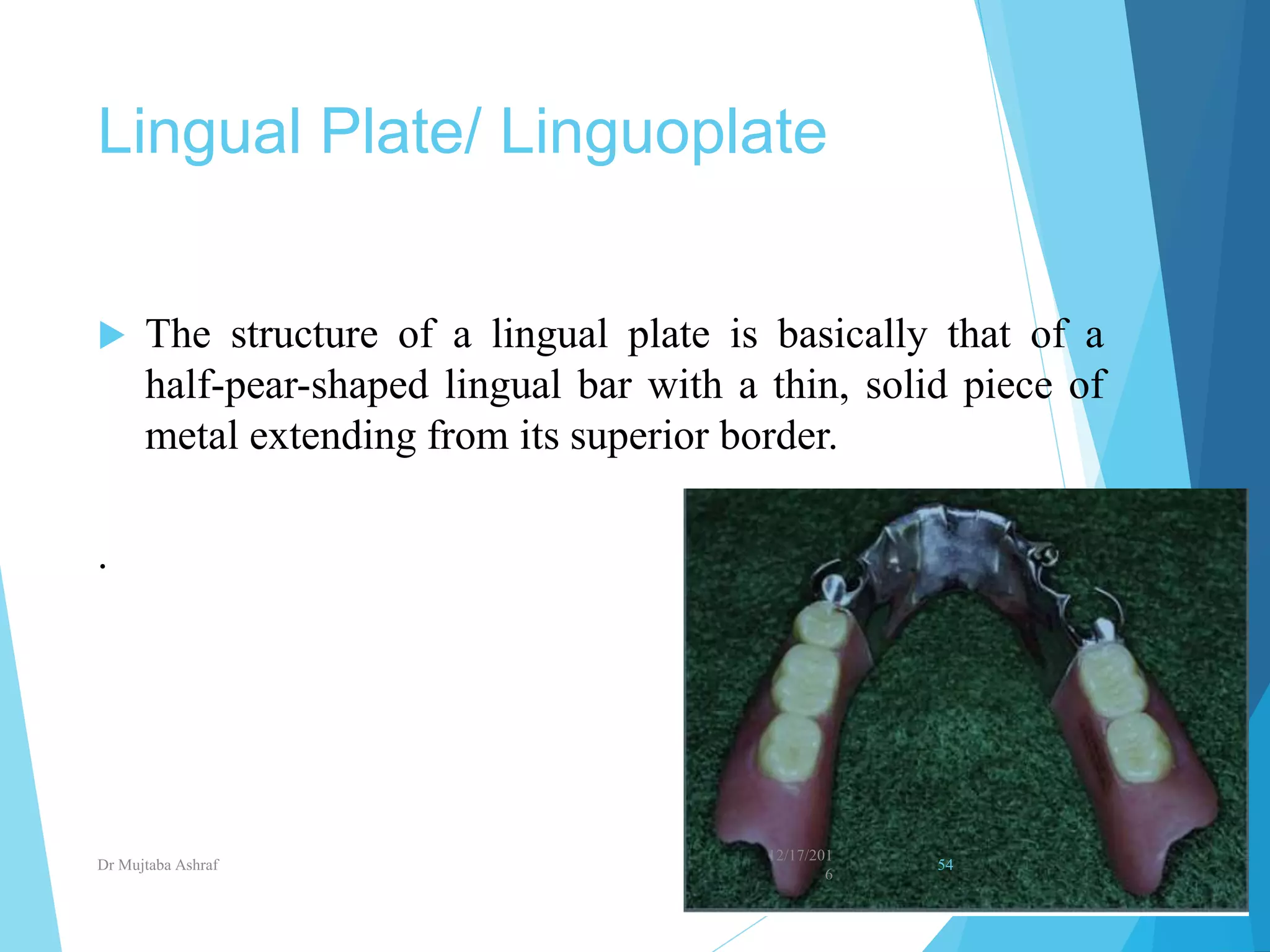 Major connector In prosthodontics | PPTX