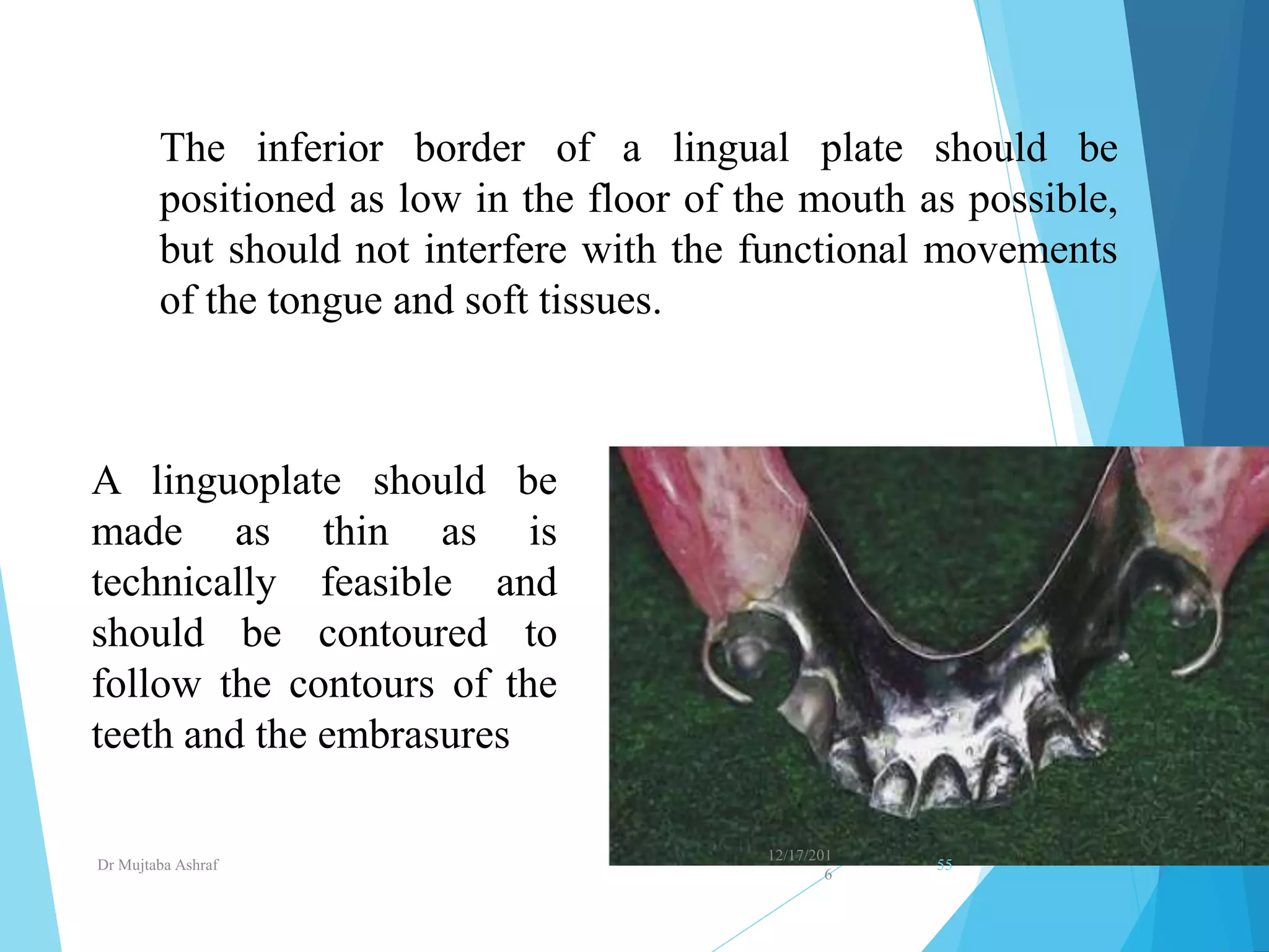 Major connector In prosthodontics | PPTX