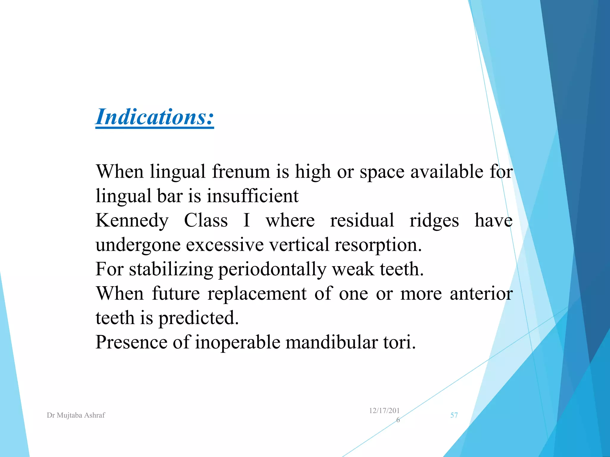 Major connector In prosthodontics | PPTX