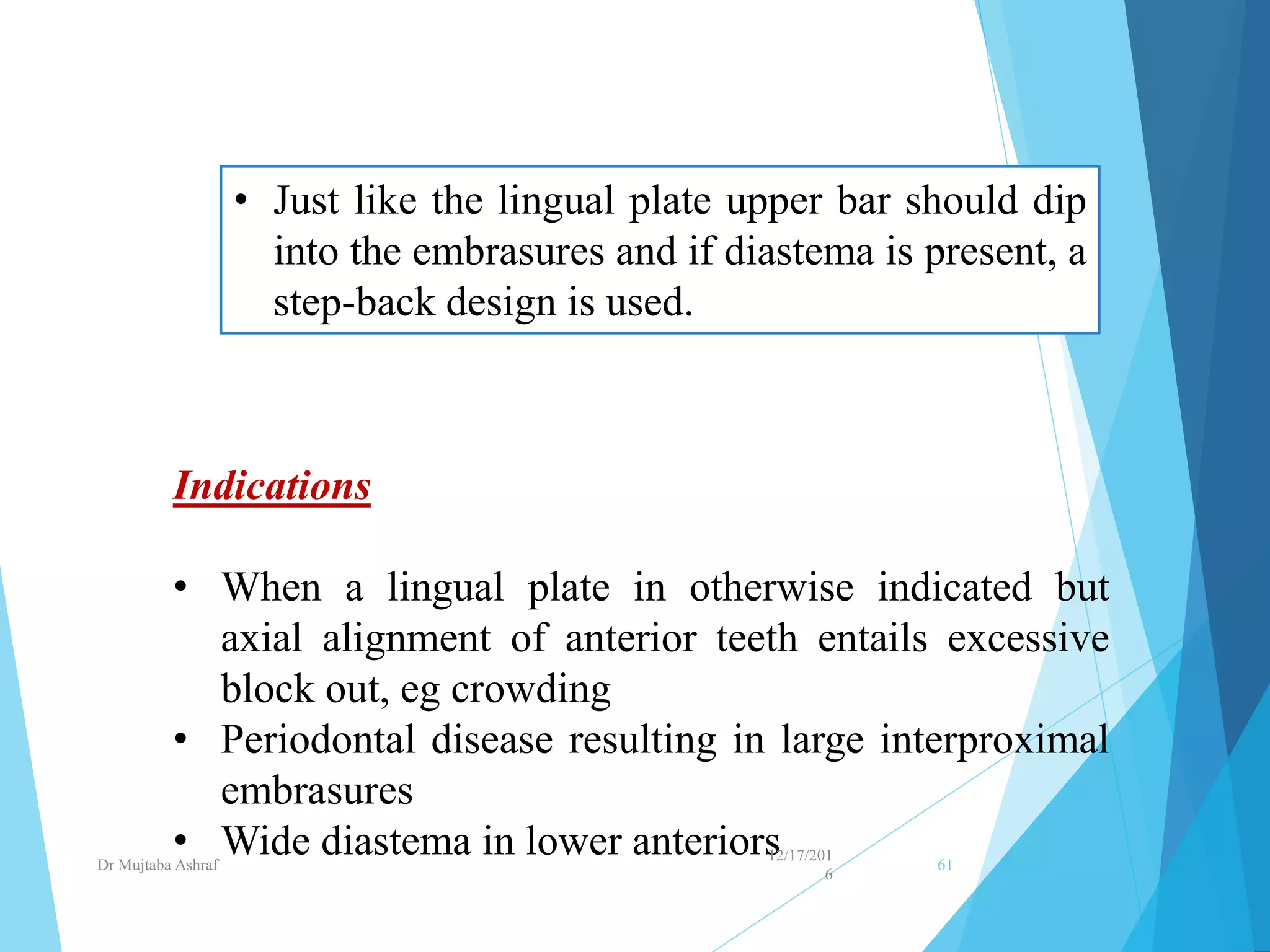 Major connector In prosthodontics | PPTX