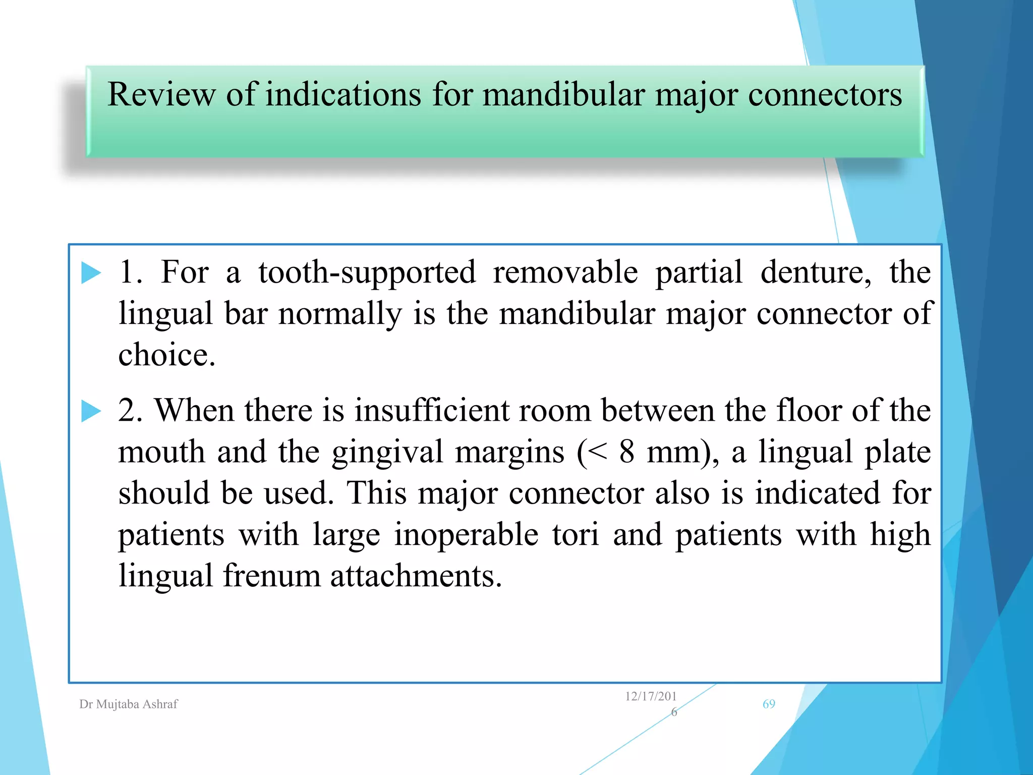 Major connector In prosthodontics | PPTX