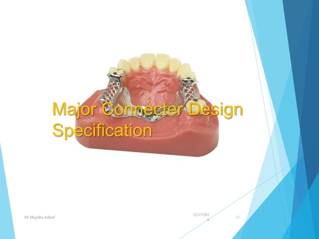Major connector In prosthodontics | PPTX | Dental Health | Diseases and ...