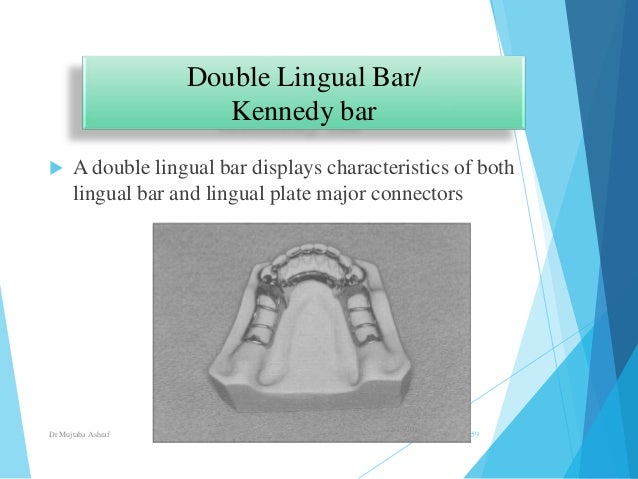Major connector In prosthodontics