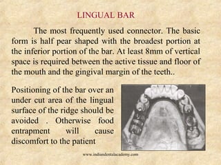 Major connectors/prosthodontic courses | PPT | Dental Health | Diseases ...