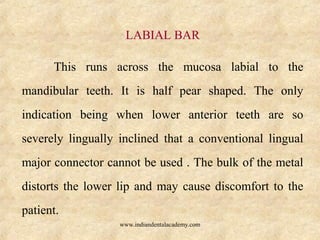 Major connectors/prosthodontic courses | PPT | Dental Health | Diseases ...