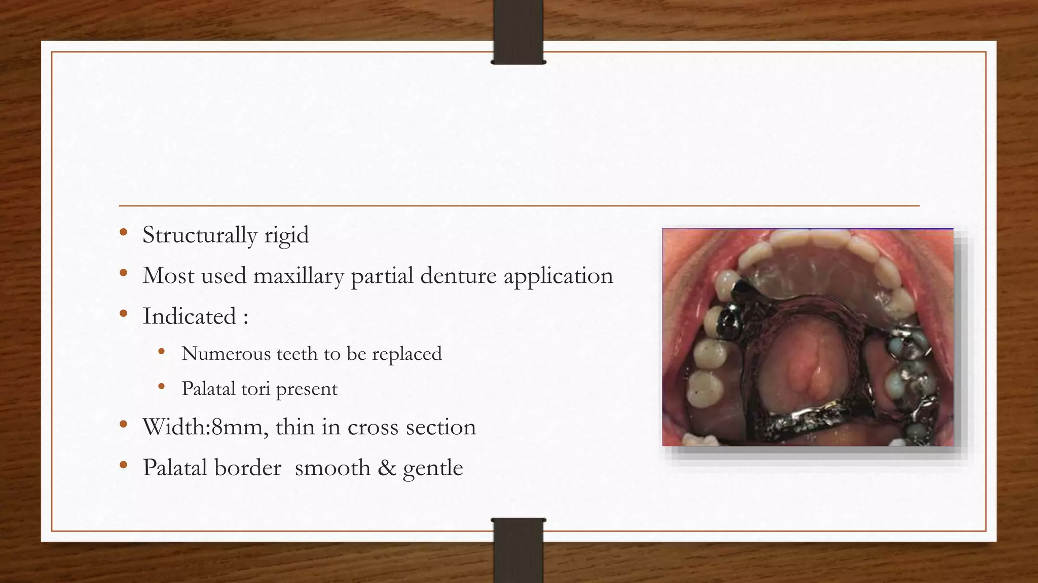 Major connectors | PPTX