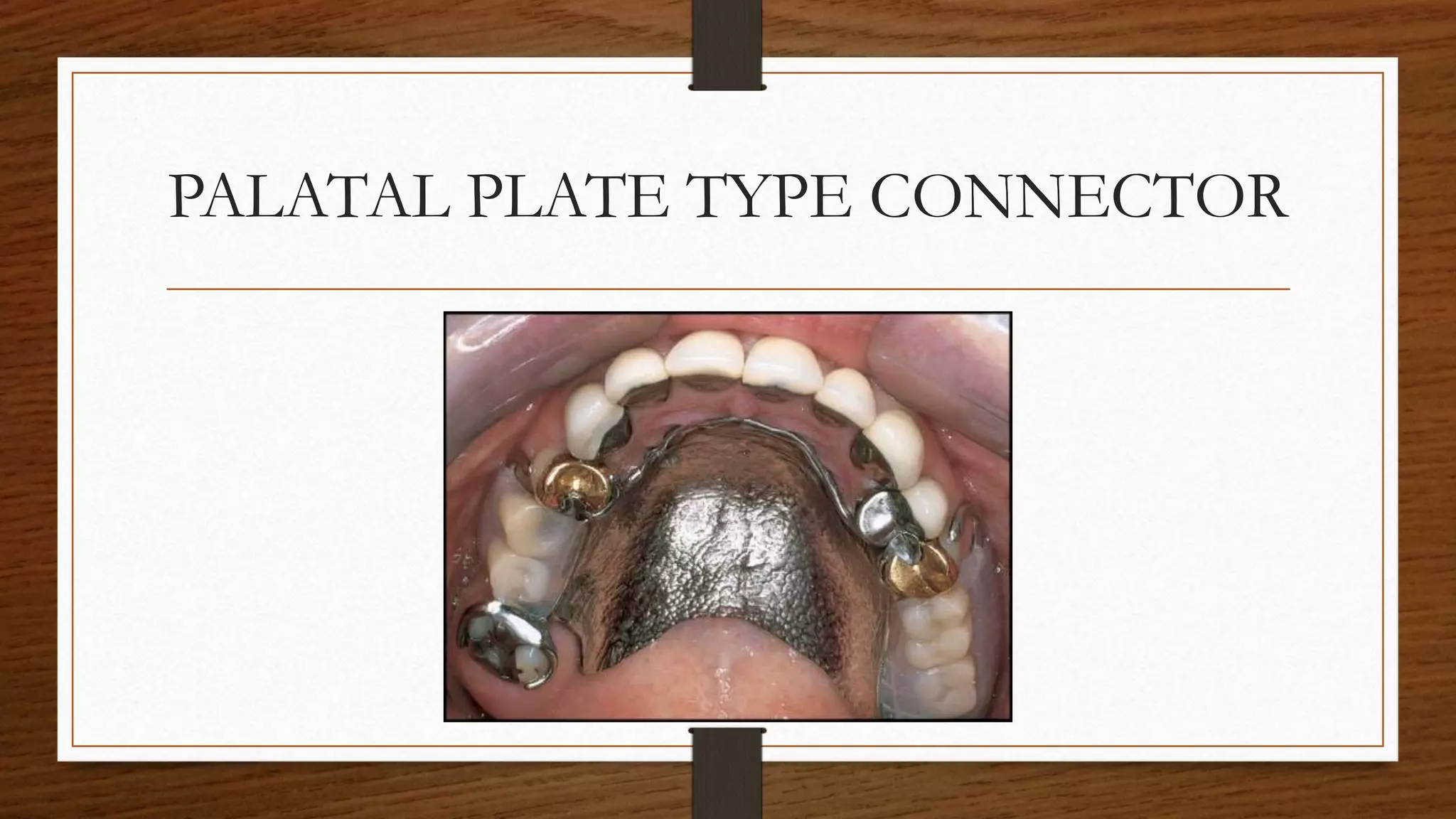 Major connectors | PPTX
