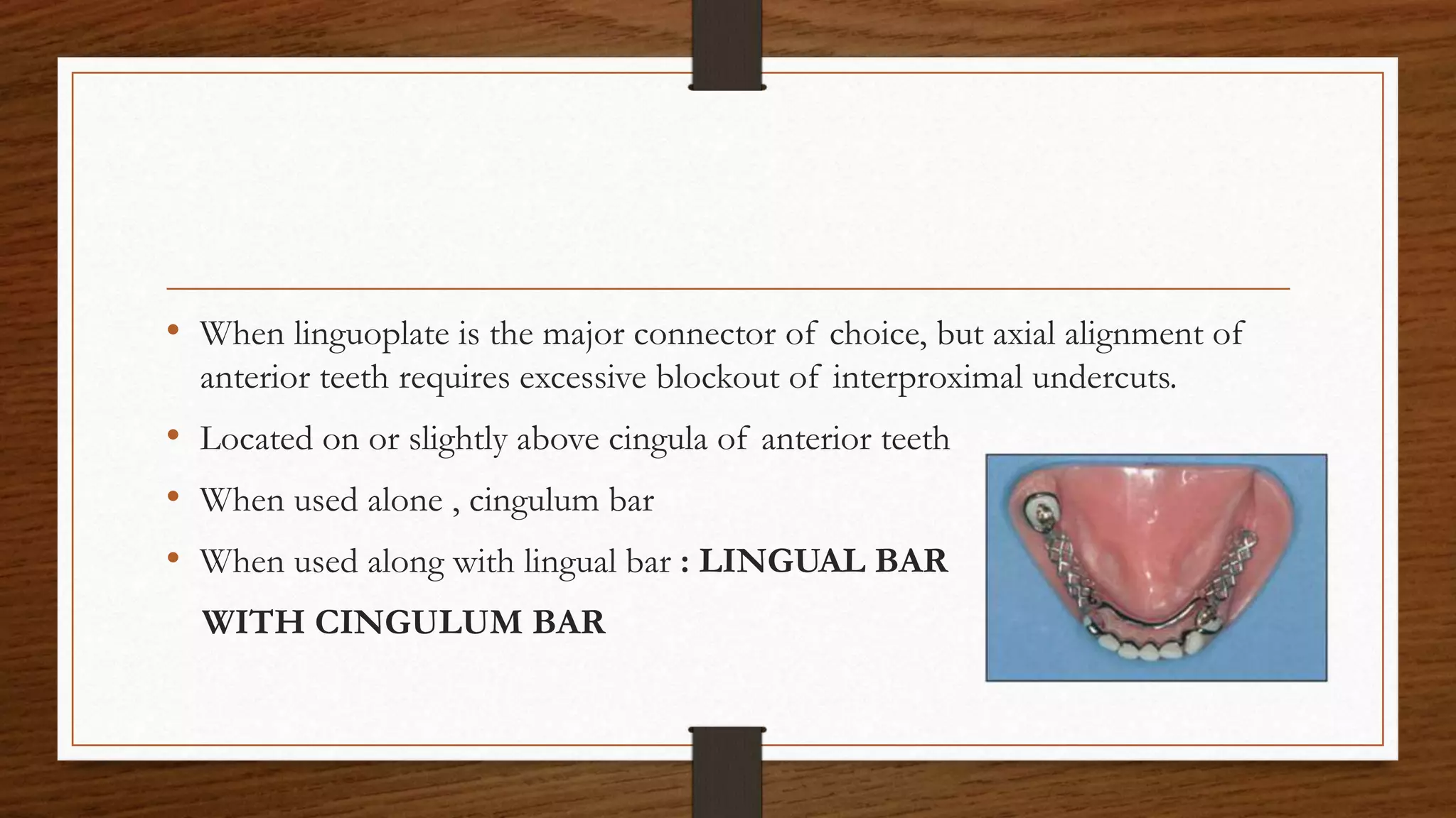 Major connectors | PPTX