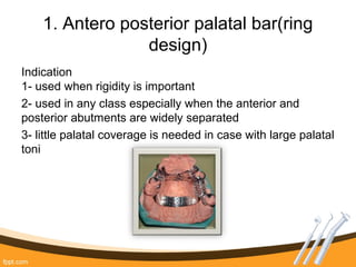 Major connectors | PPT