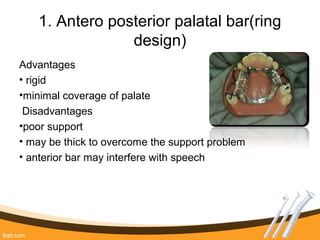 Major connectors | PPT