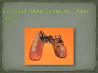 MAJOR CONNECTORS.ppt