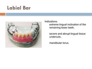 MAJOR connectors.pptx of removable partial denture | PPTX