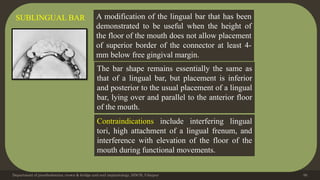 Major connectors | PPTX | Dental Health | Diseases and Conditions