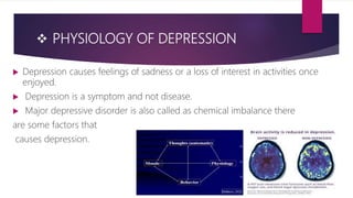Major depressive disorder | PPTX