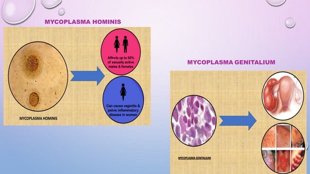 Major groups of bacteria: Spirochetes, Chlamydia, Rickettsia, nanobes ...