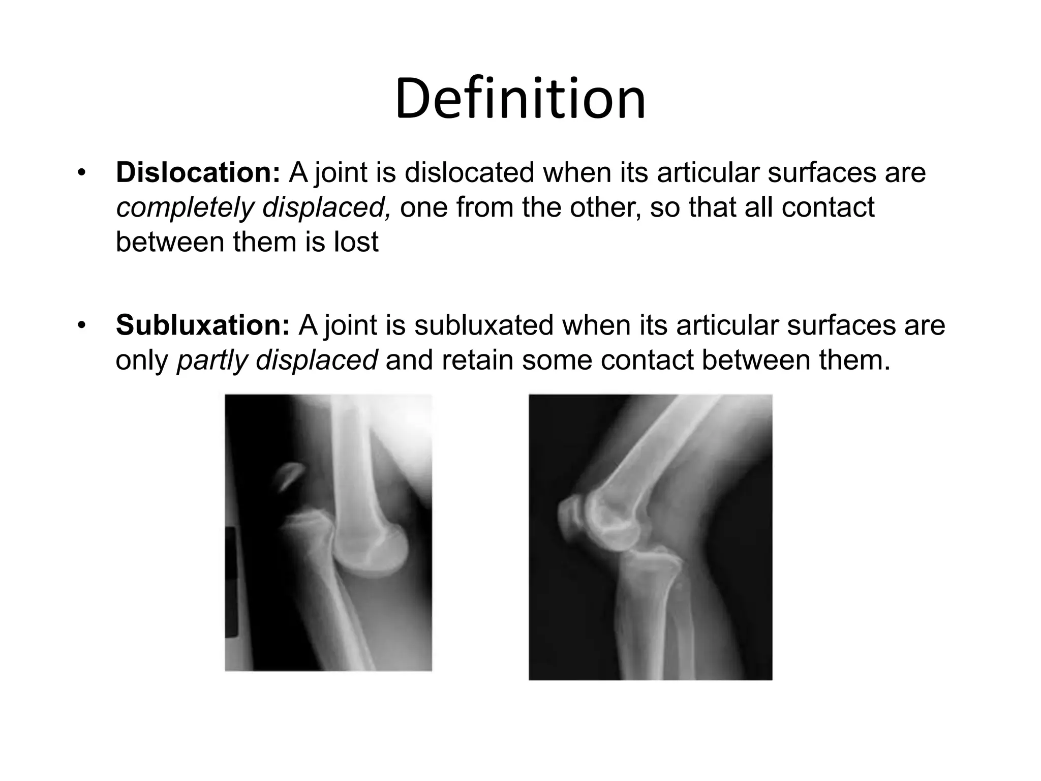 Major Joint dislocations by Dr Prassan Tripathi | PPTX