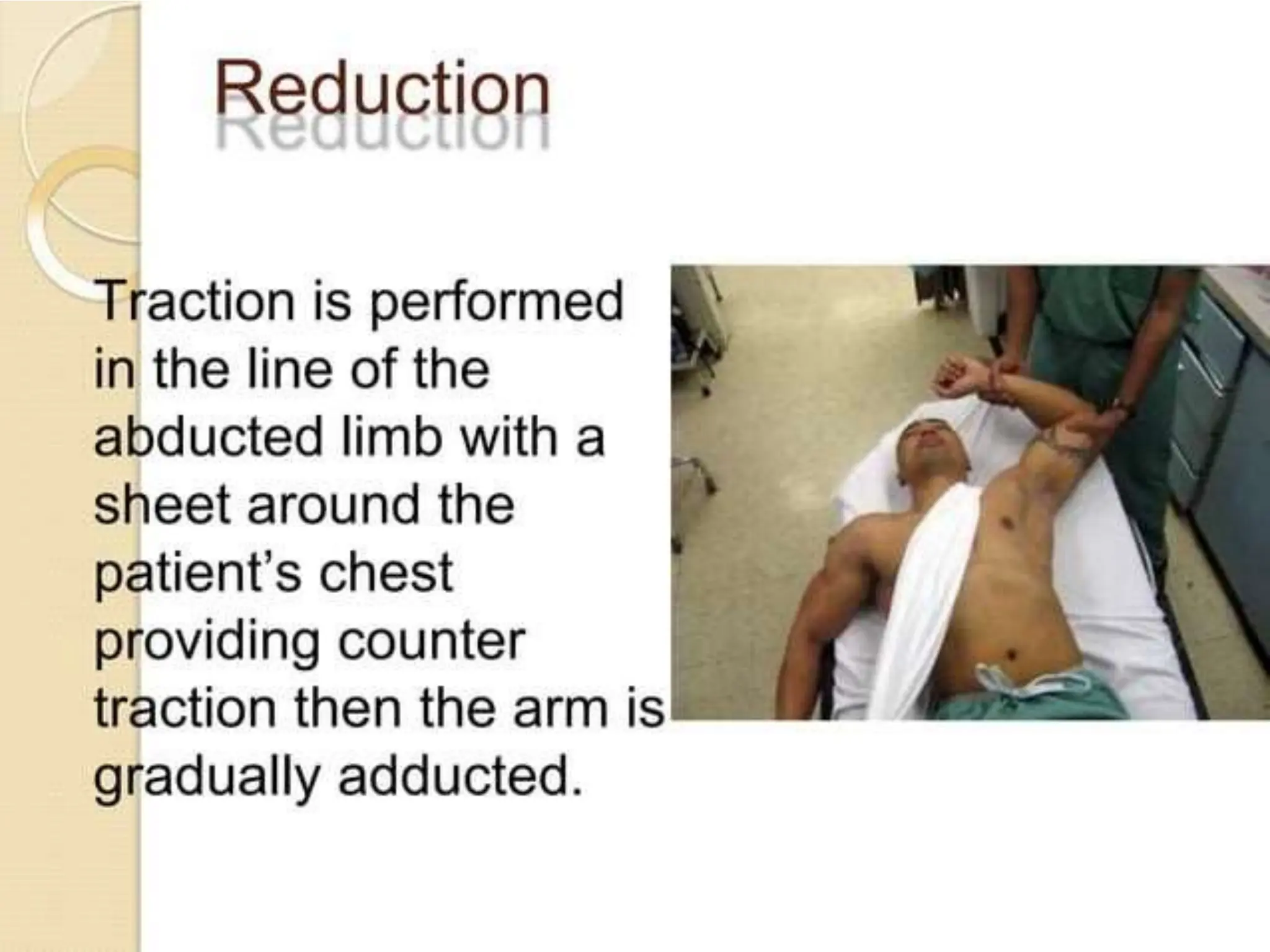 Major Joint dislocations by Dr Prassan Tripathi | PPTX
