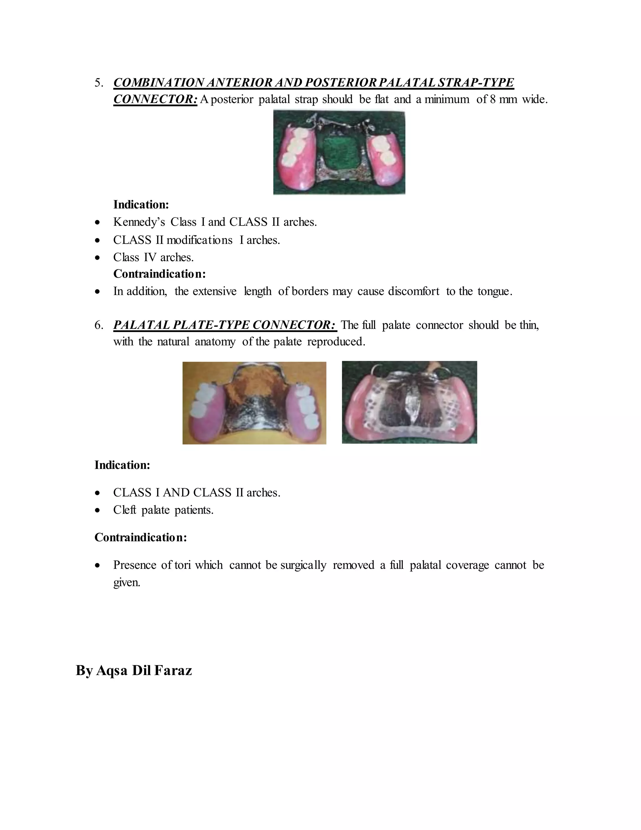 Major Maxillary Connectors | DOCX
