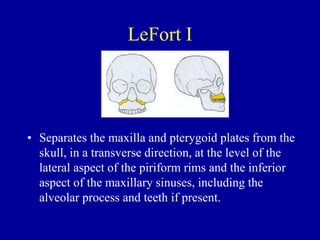 Major Midface Trauma.ppt