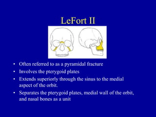 Major Midface Trauma.ppt