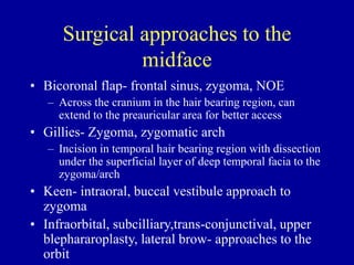 Major Midface Trauma.ppt