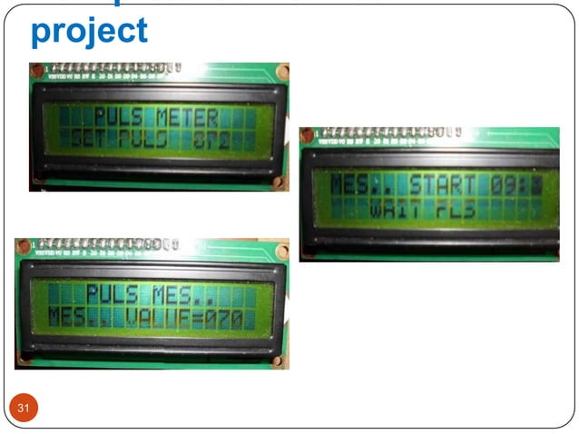 Heart beat monitor using AT89S52 microcontroller | PPTX