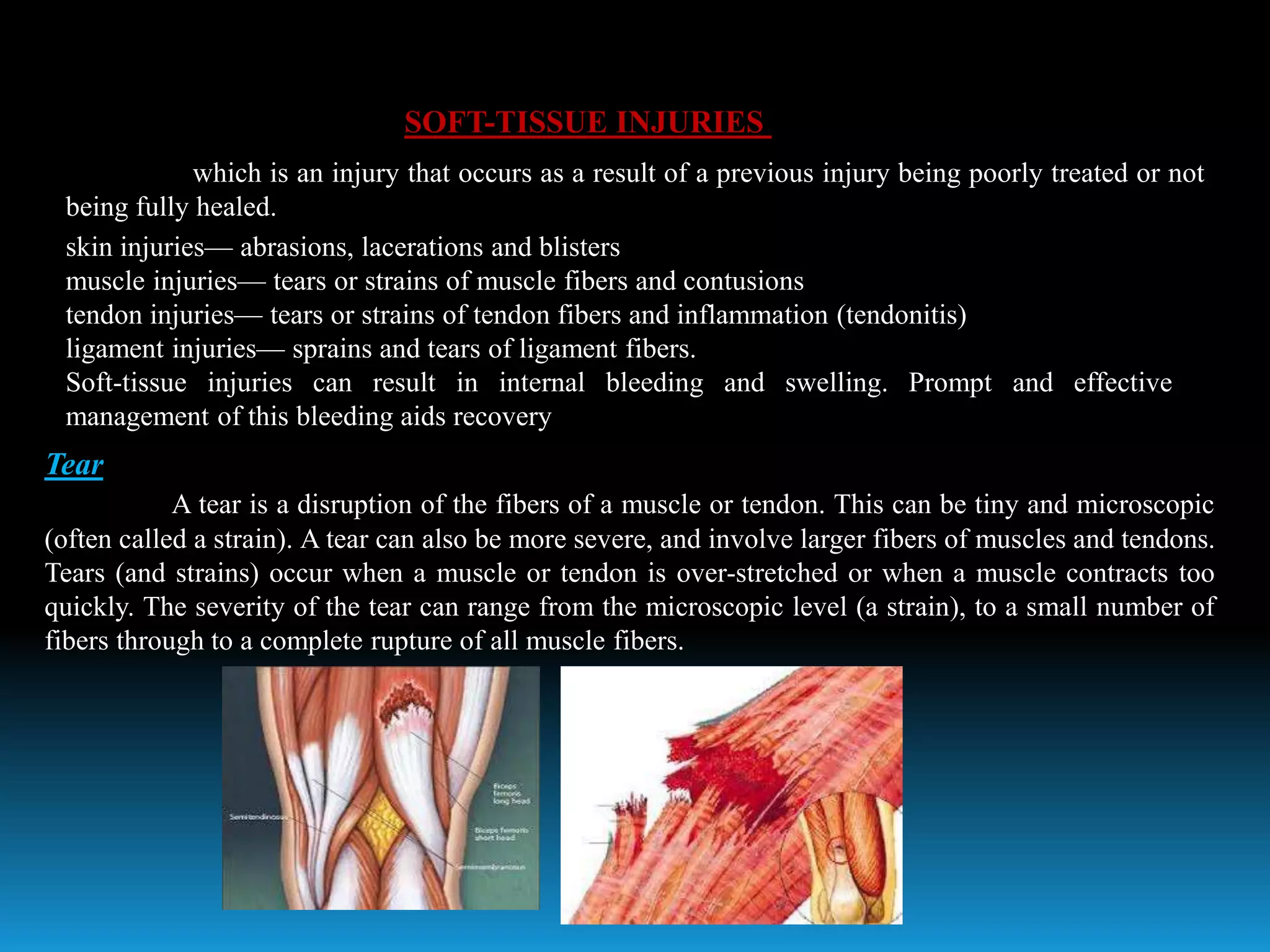 Major sports injuries and classification of injuries | PPTX