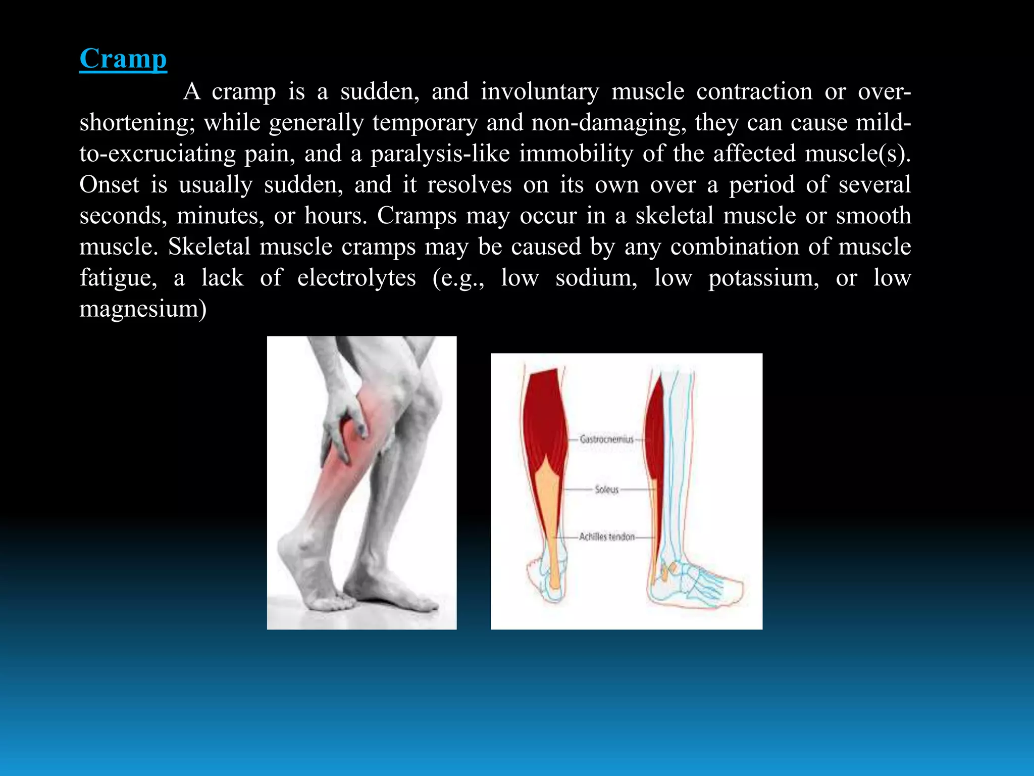 Major sports injuries and classification of injuries | PPTX